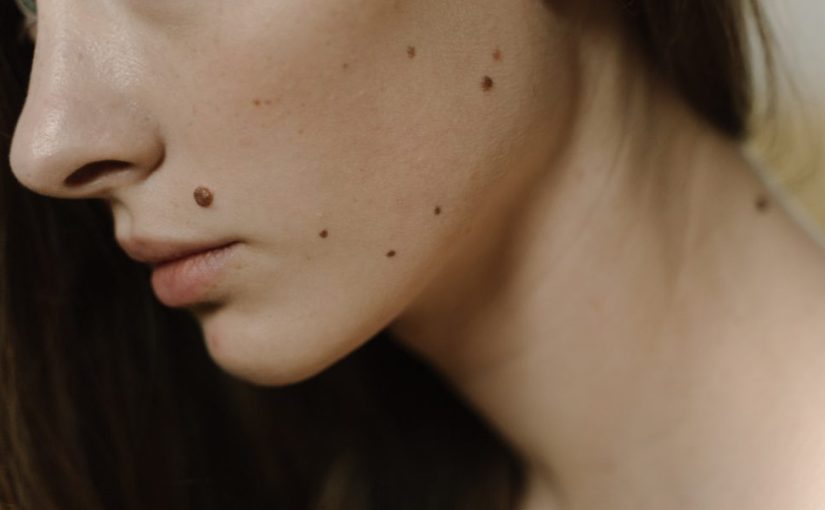 Transformative Approaches to Safe and Painless Removal